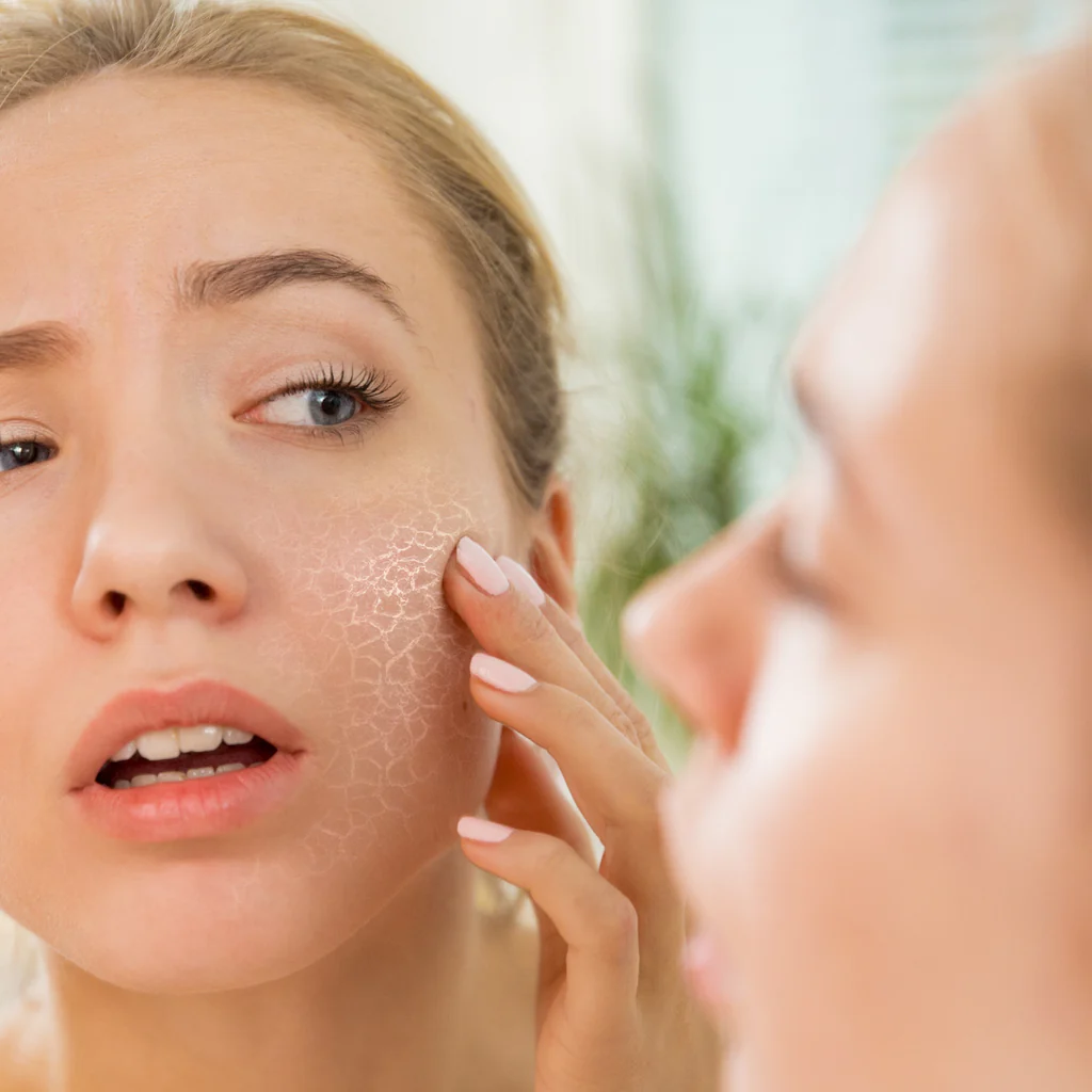 Achieving Radiant Skin: Ultimate Hydration Guide Achieving Radiant Skin: Ultimate Hydration Guide